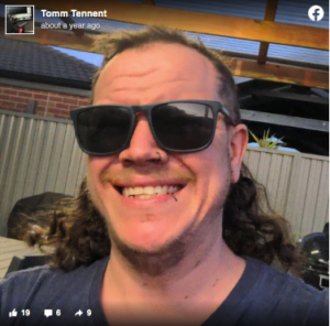 Tomm Tennent: The unique baby born with enough skin to cover the body ...