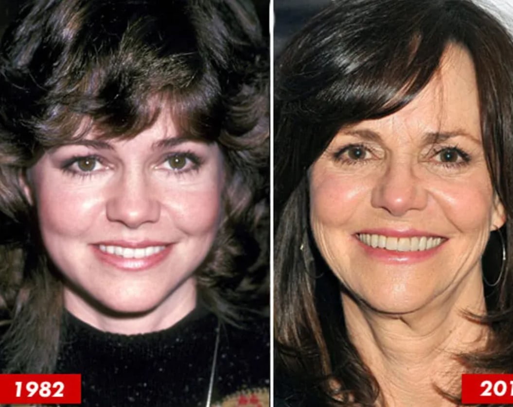 After undergoing face surgery, Sally Field felt “invisible” since her ...